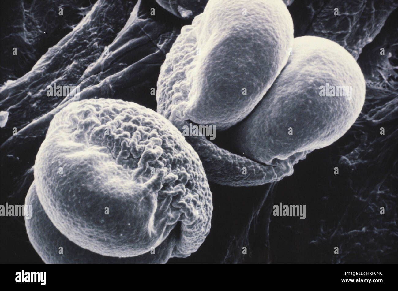 Pine Pollen (SEM Stock Photo - Alamy