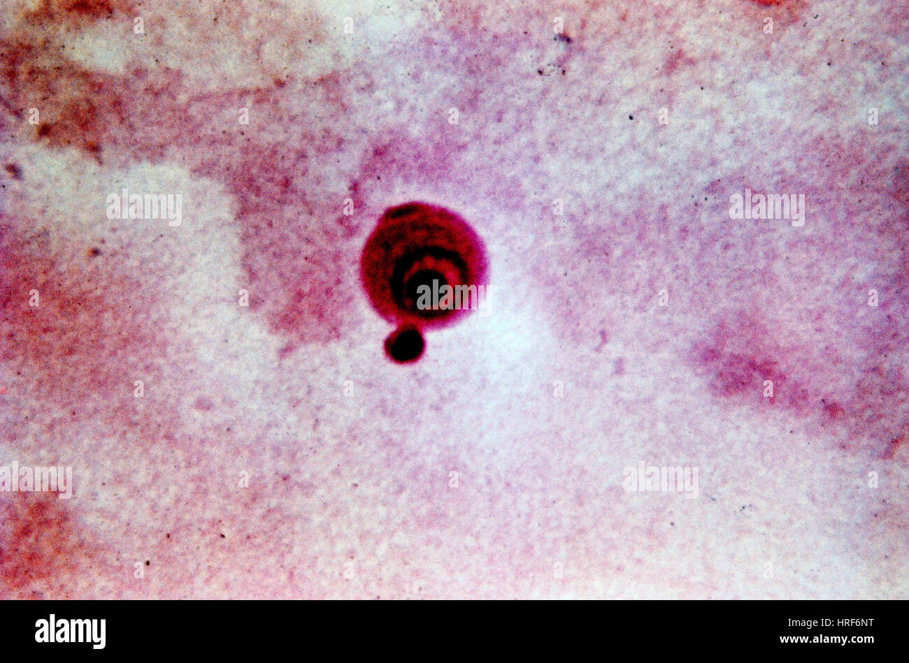 Intranuclear inclusions hi-res stock photography and images - Alamy