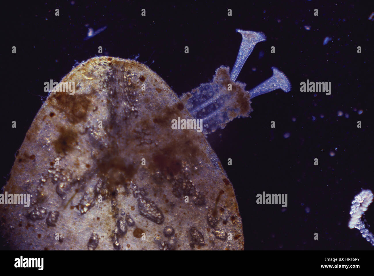 Stentor protozoan micrograph hi-res stock photography and images - Alamy