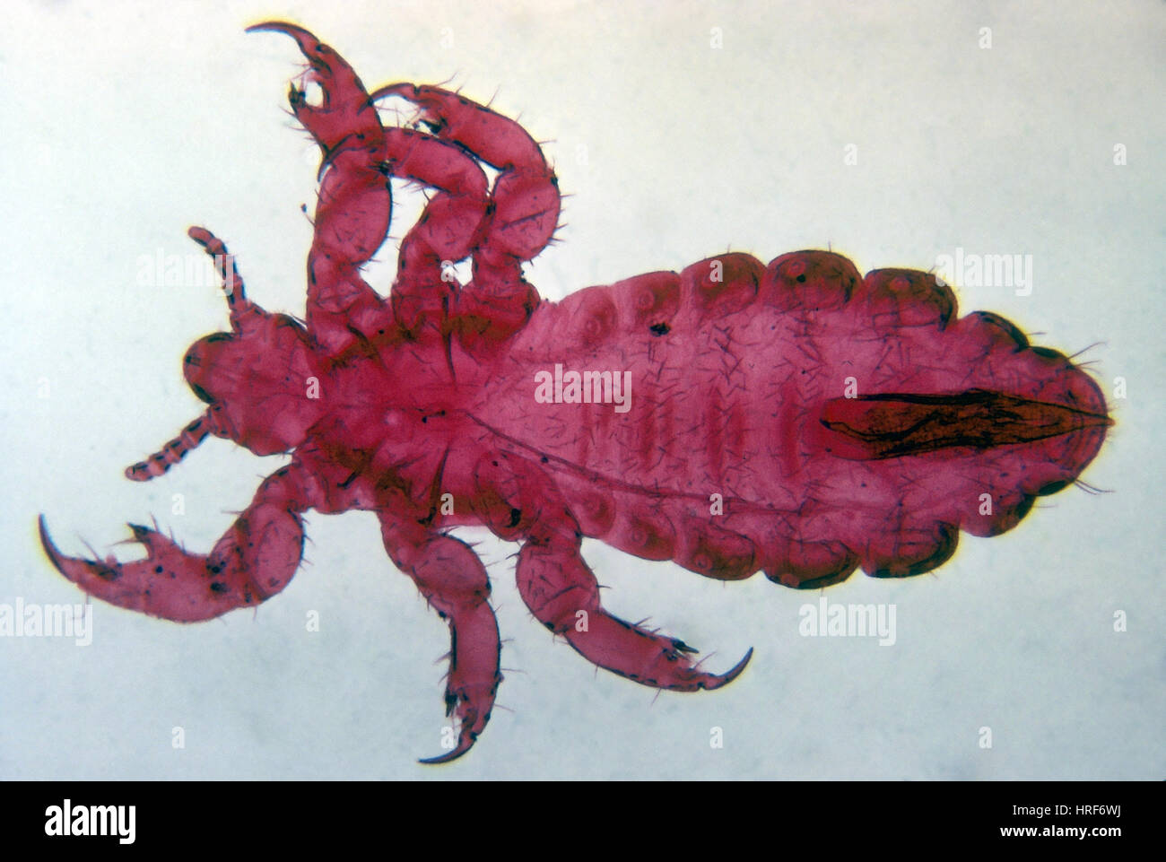 Pediculidae hi-res stock photography and images - Alamy
