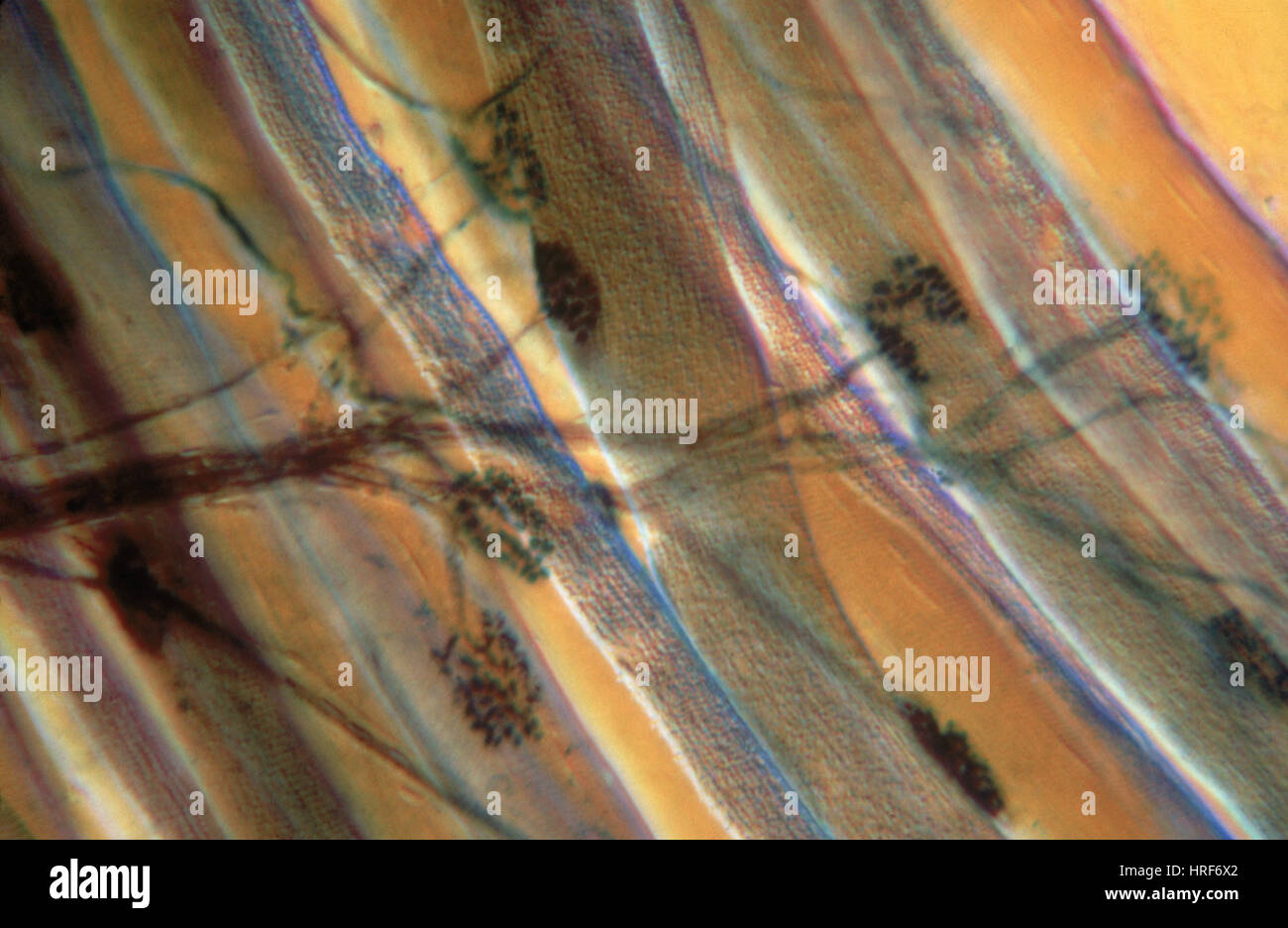 Motor End Plate Stock Photo - Alamy