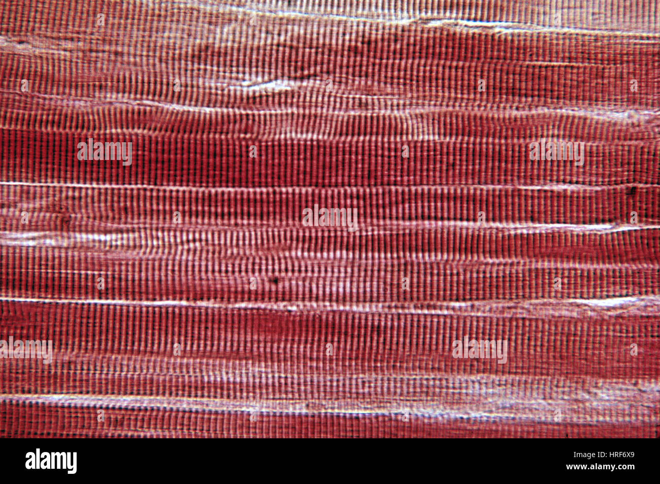 Skeletal muscle fiber hi-res stock photography and images - Alamy