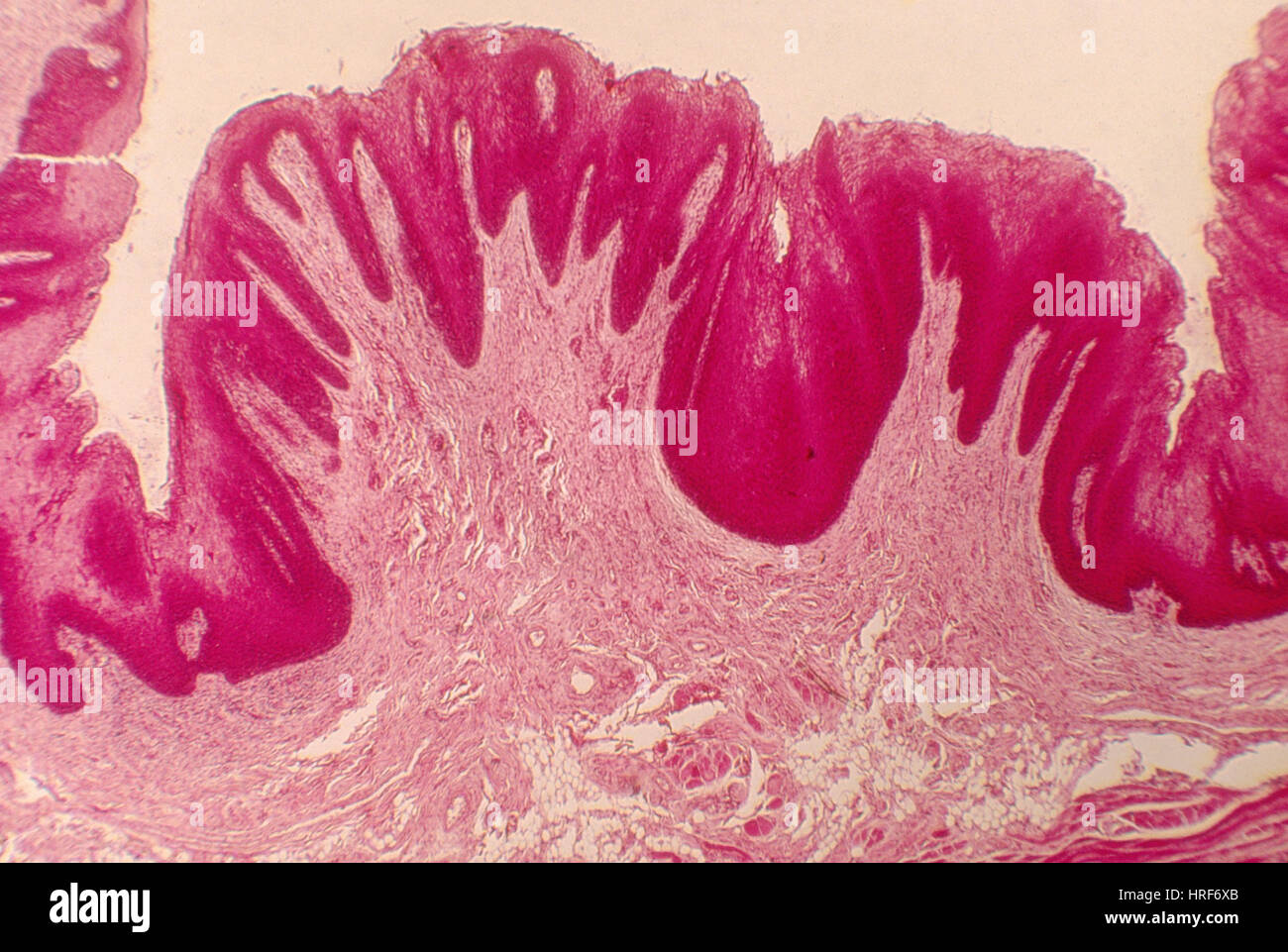 Tongue papillae lm hi-res stock photography and images - Alamy