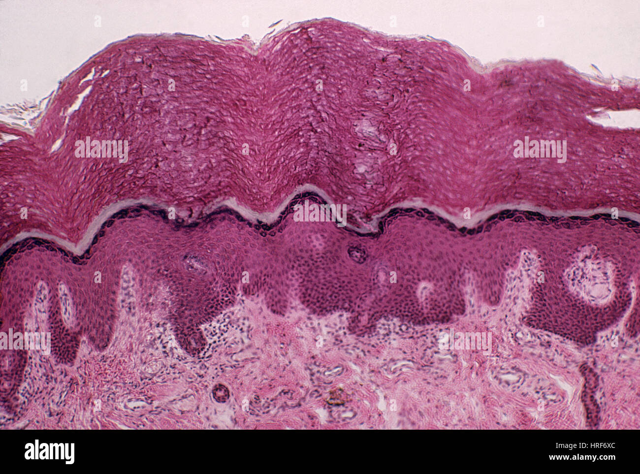Skin cells magnified hi-res stock photography and images - Alamy