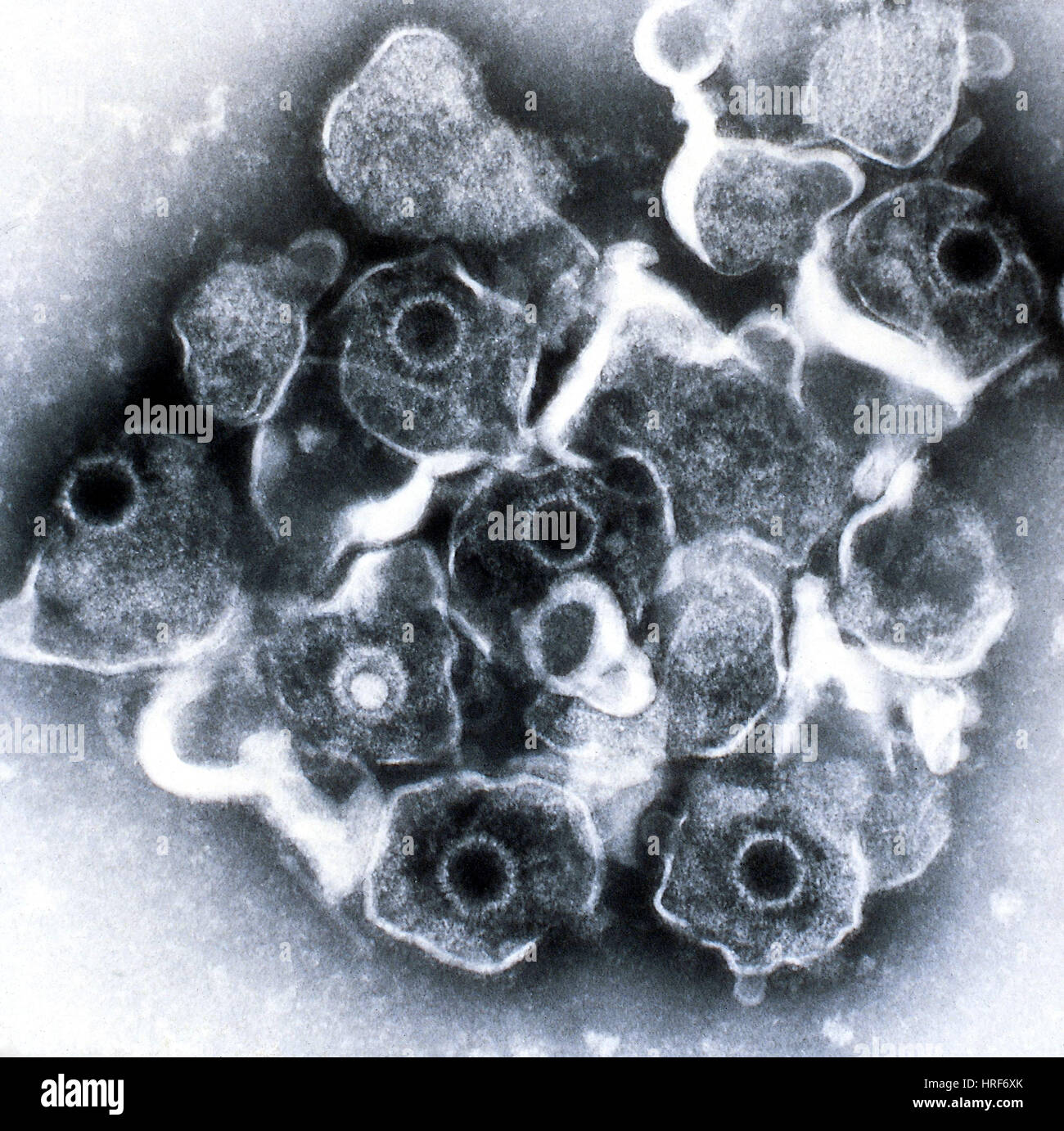 Herpes Simplex Virus (TEM Stock Photo - Alamy