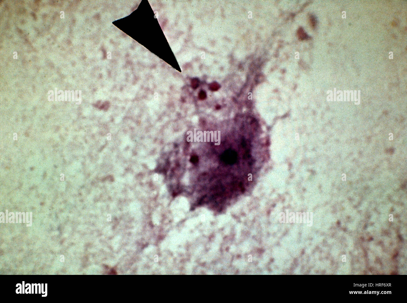 LM of Negri Bodies Stock Photo - Alamy