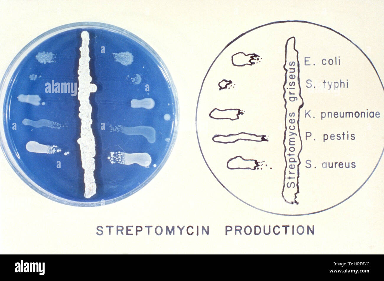 Streptomyces hi-res stock photography and images - Alamy