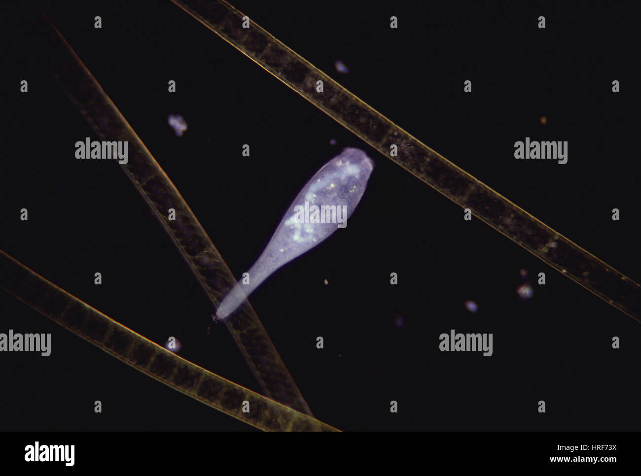 Stentor protozoan micrograph hi-res stock photography and images - Alamy