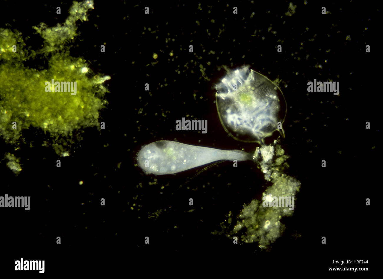 Stentor protozoan micrograph hi-res stock photography and images - Alamy
