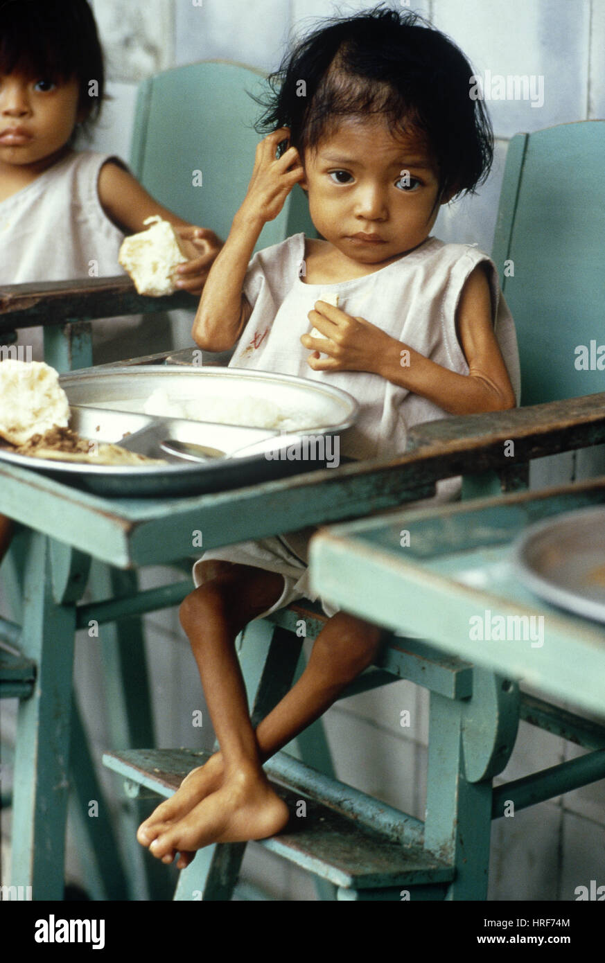 Malnutrition child poverty hi-res stock photography and images - Alamy