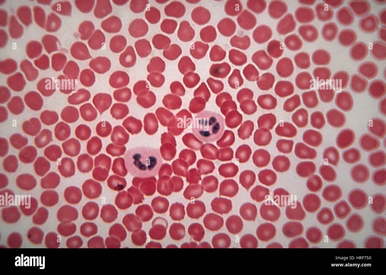 Blood smear showing red blood cells hi-res stock photography and images ...