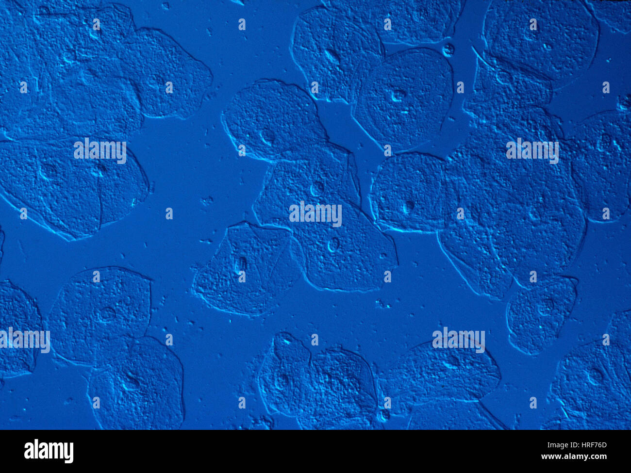 Epithelial cells micrograph hi-res stock photography and images - Alamy