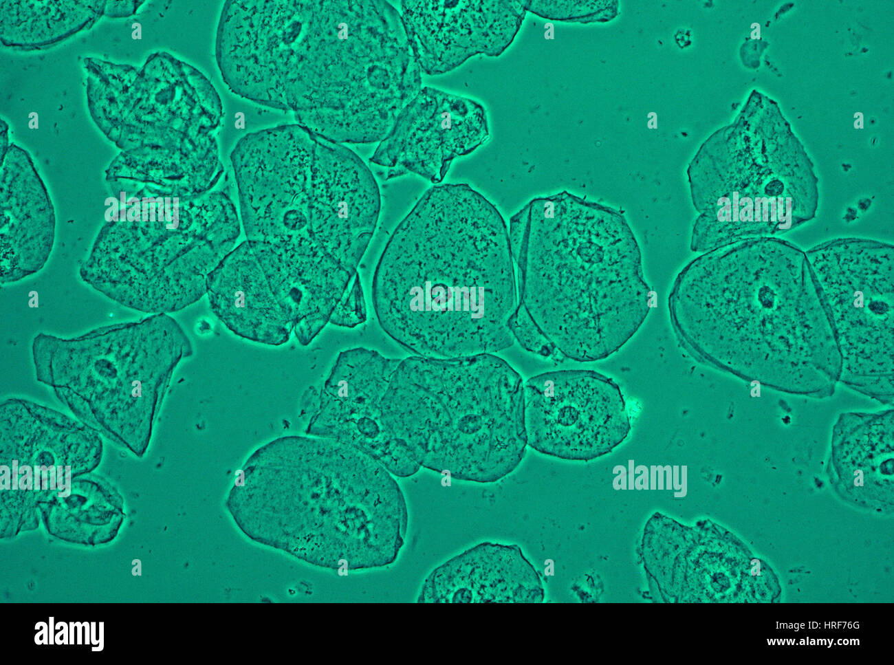 Epithelial cells micrograph hi-res stock photography and images - Alamy