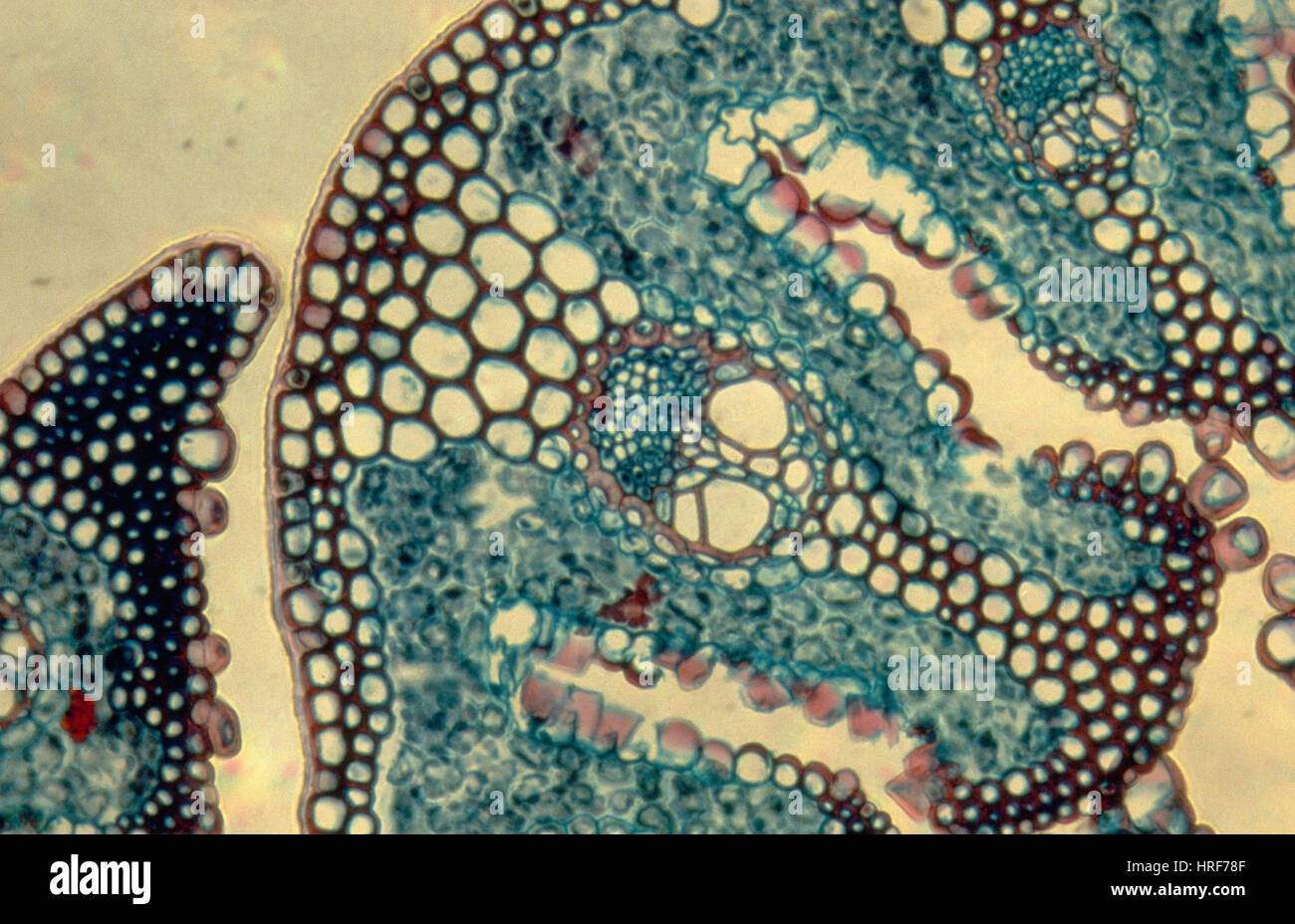 Sclereids hi-res stock photography and images - Alamy