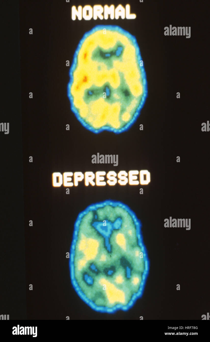 Human brain activity scans hi-res stock photography and images - Alamy