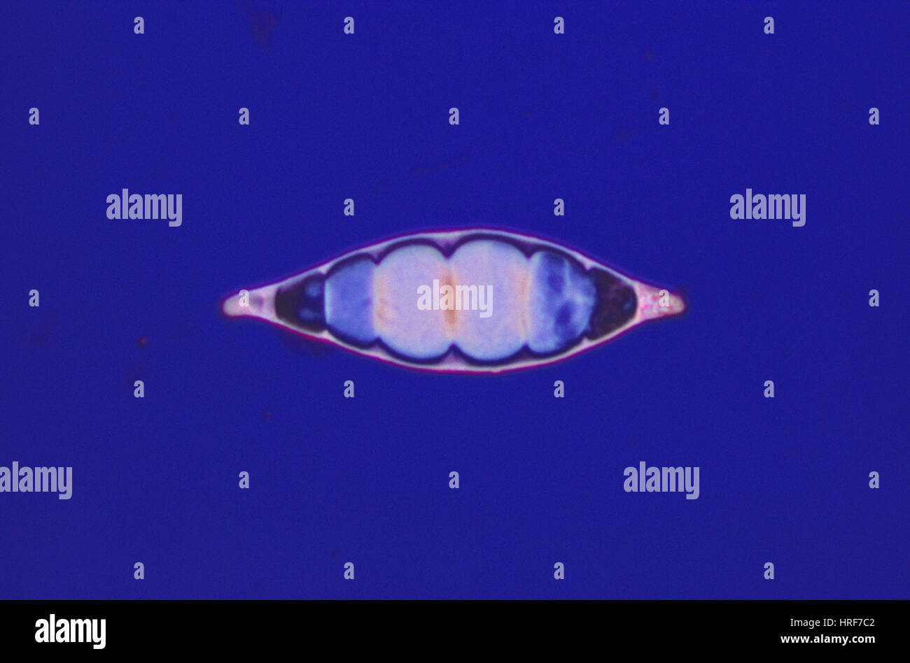 Microsporum canis hi-res stock photography and images - Alamy