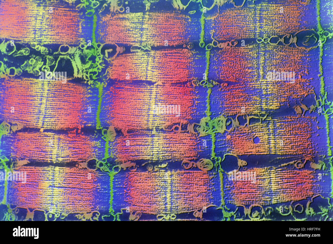 Skeletal muscle cell hi-res stock photography and images - Alamy