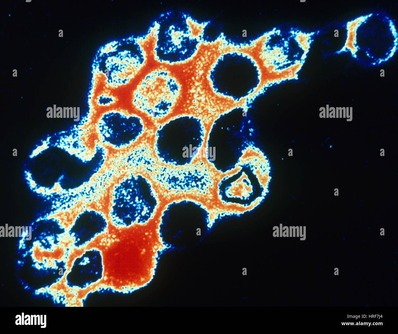 German measles hi-res stock photography and images - Alamy