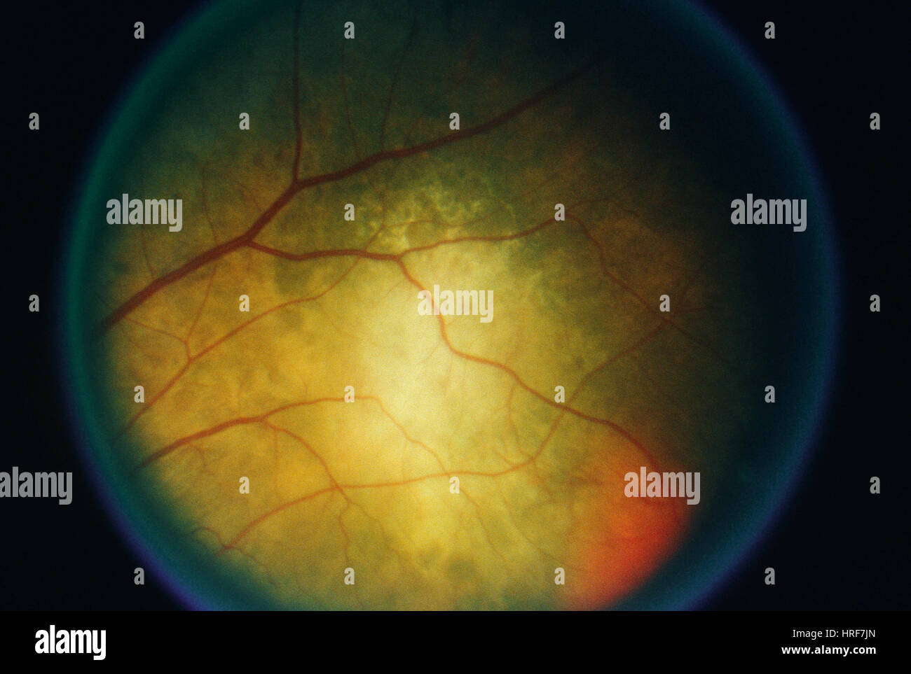 Retinography hi-res stock photography and images - Alamy
