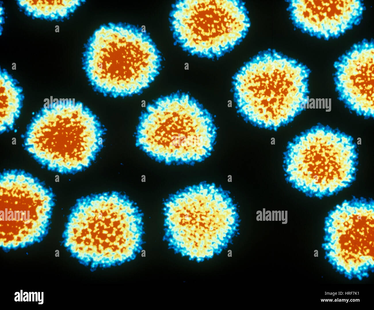 Adenovirus microscopy hi-res stock photography and images - Alamy