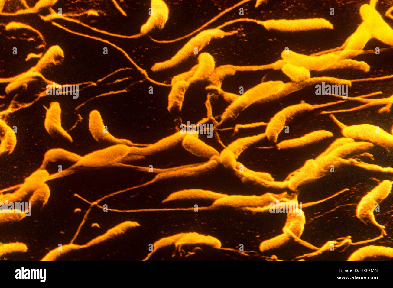 Colorized scanning electron micrograph filamentous hi-res stock ...