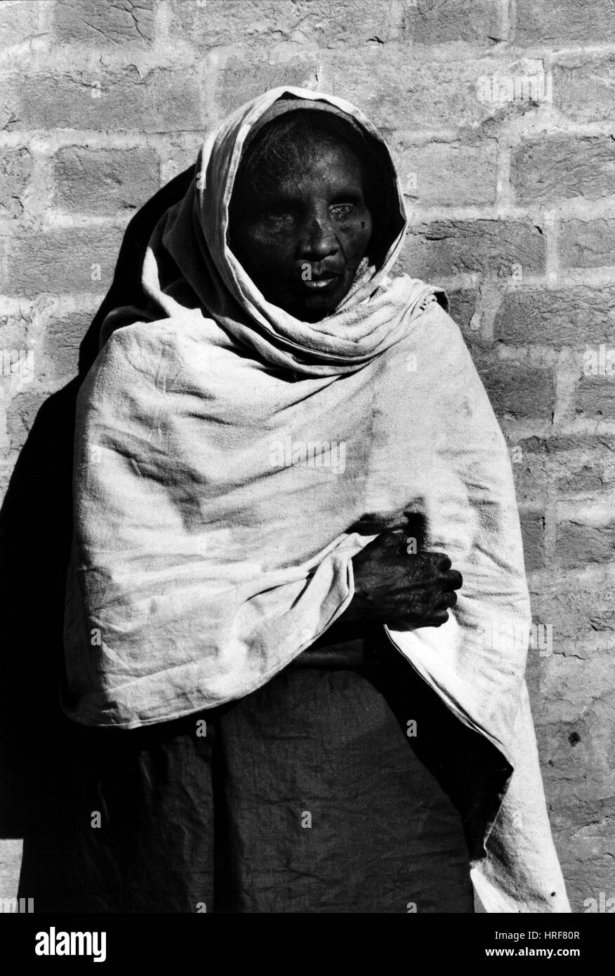 Leprosy stigma hi-res stock photography and images - Alamy