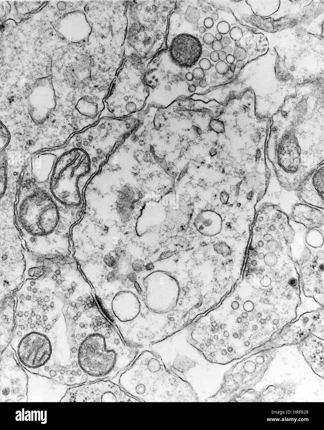 Normal neuron Black and White Stock Photos & Images - Alamy