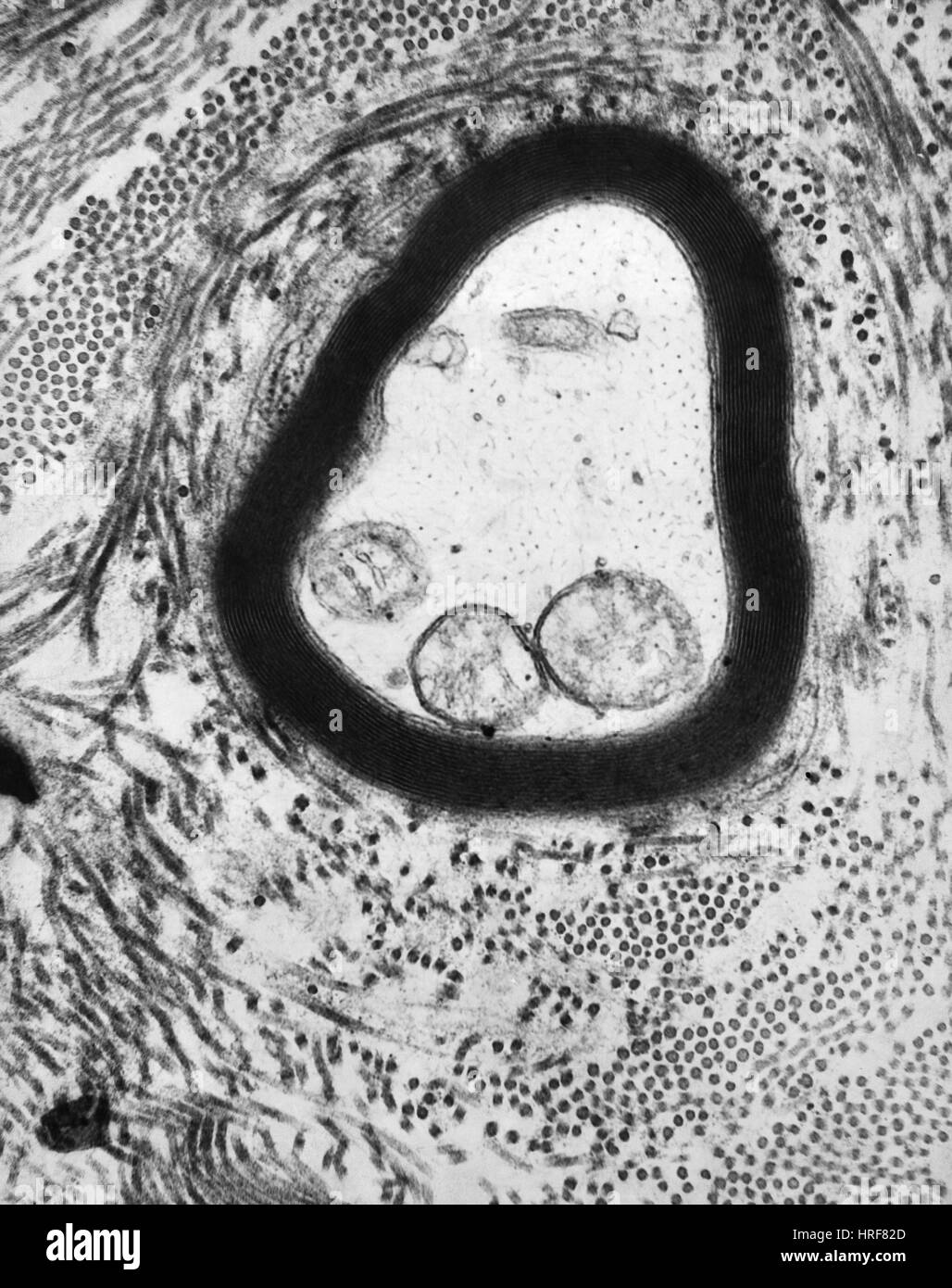 Neuron axon micrograph hi-res stock photography and images - Alamy