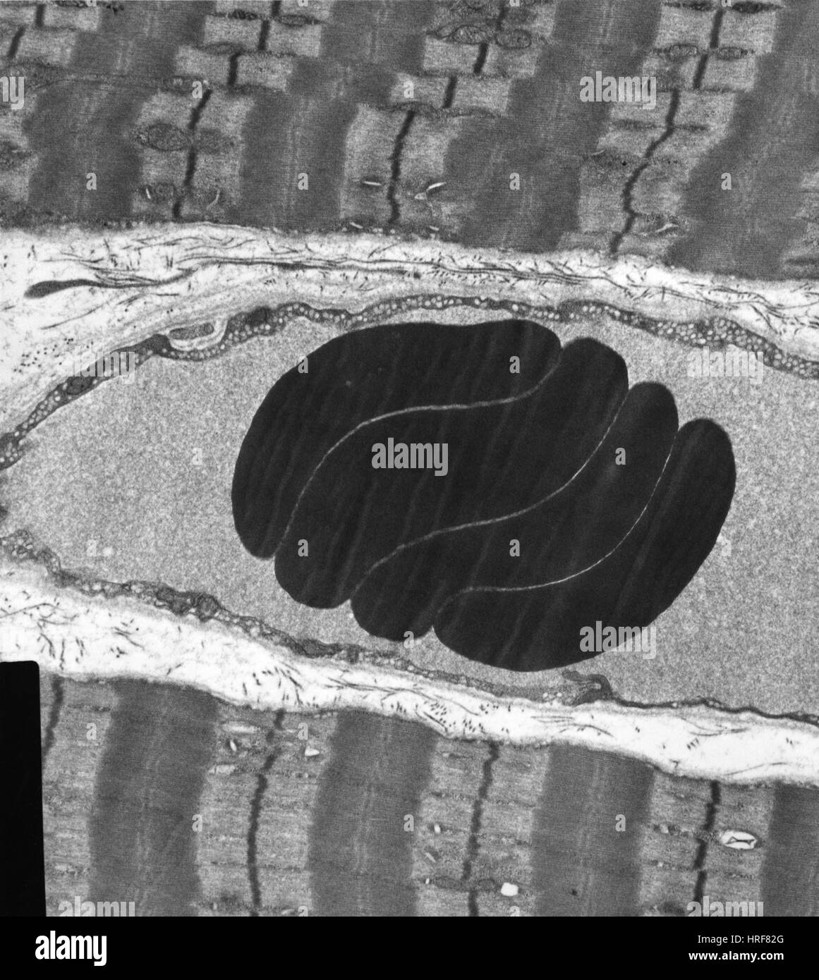 Micrograph blood capillary hi-res stock photography and images - Alamy