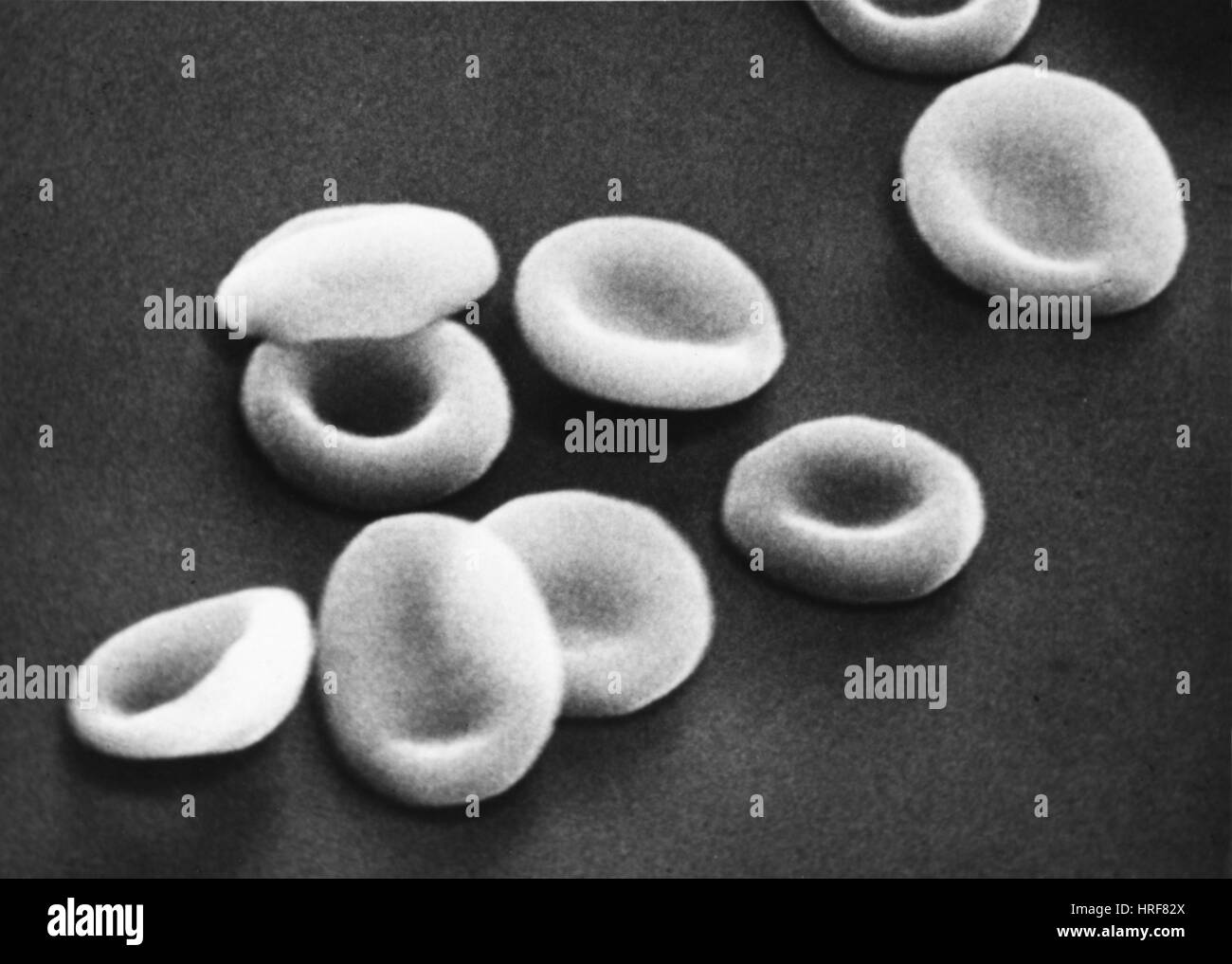 Red white human blood Black and White Stock Photos & Images - Alamy