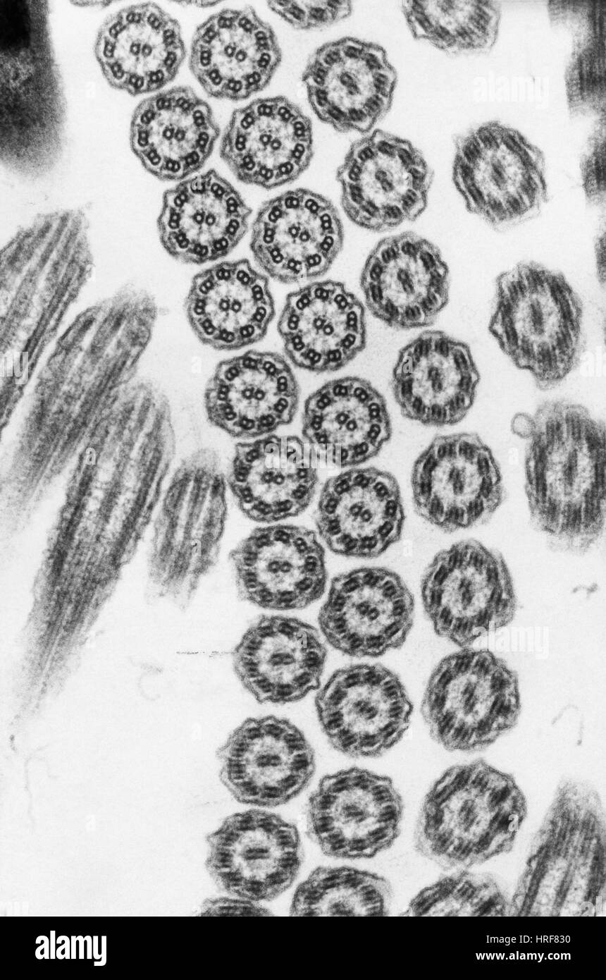 Cilia electron micrograph hi-res stock photography and images - Alamy