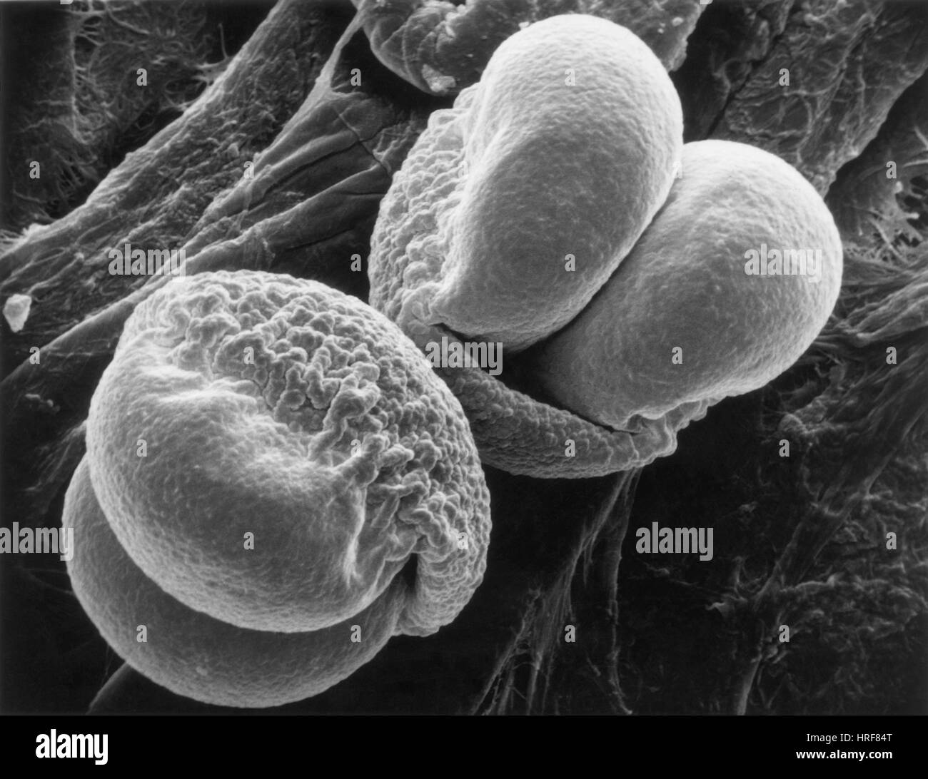 Scanning Electron Micrograph Black and White Stock Photos & Images - Alamy