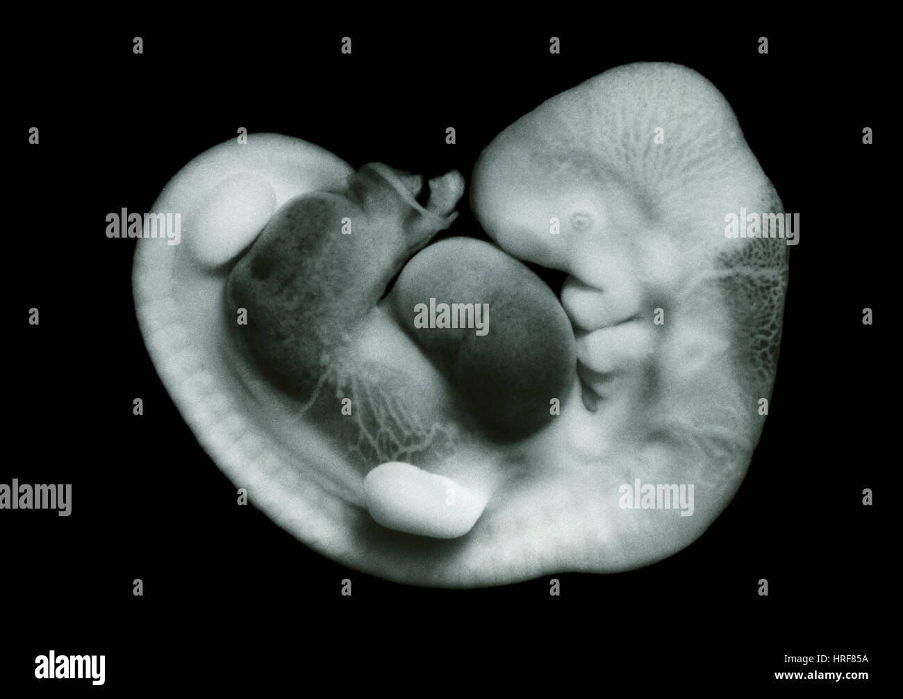 35 day old human embryo Stock Photo - Alamy