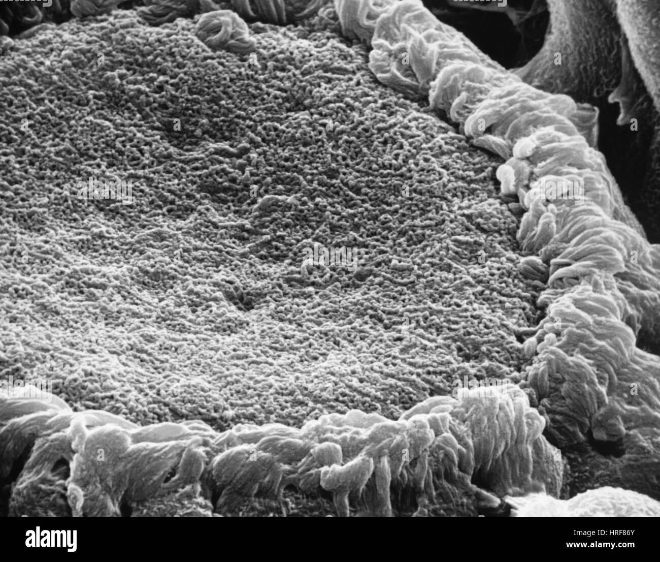 Scanning electron micrograph taste hi-res stock photography and images ...