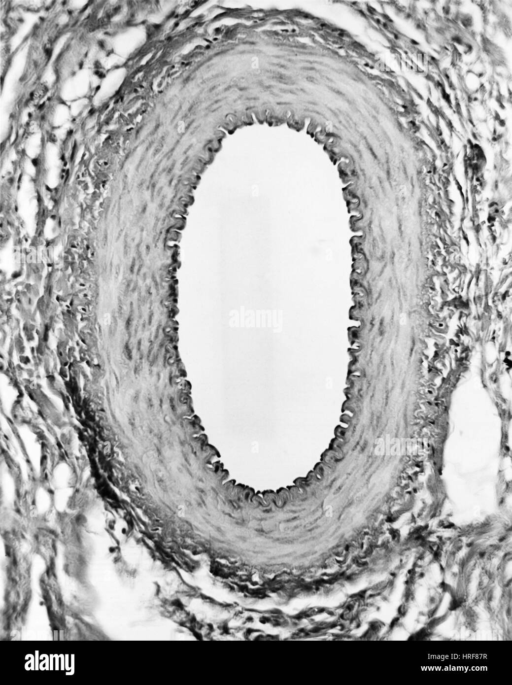 Normal Artery, TEM Stock Photo - Alamy