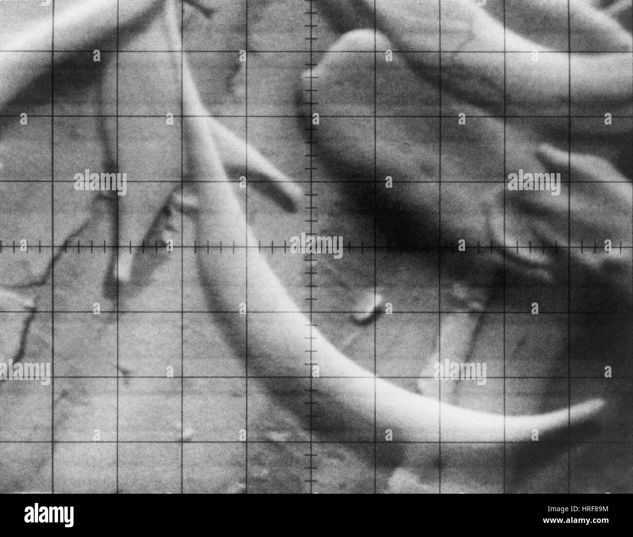 Blood cell sickle cell Black and White Stock Photos & Images - Alamy