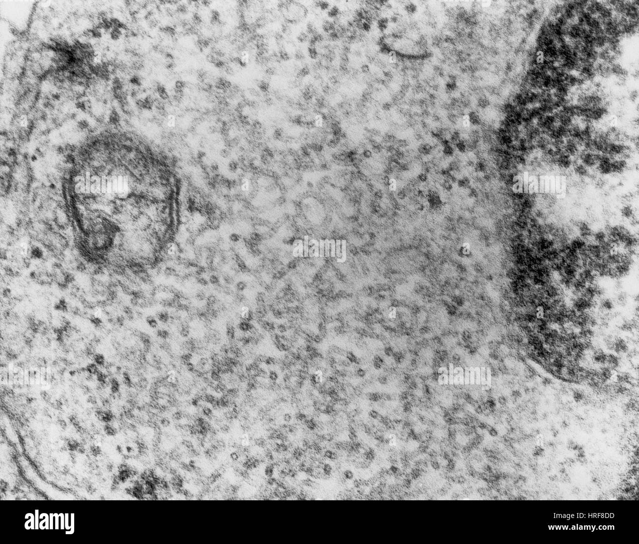 Mumps Virus, TEM Stock Photo - Alamy