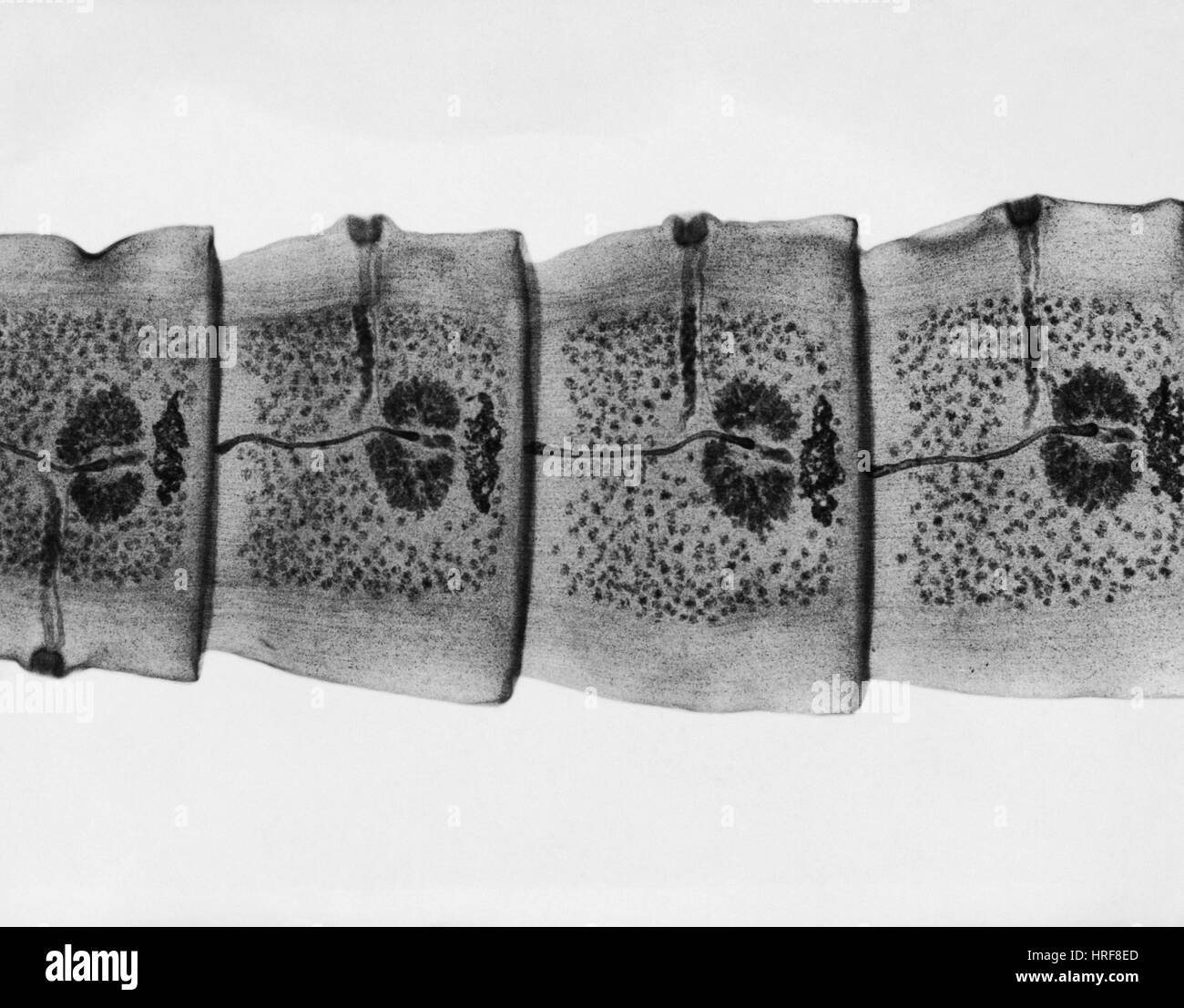 Tapeworm parasite animal Black and White Stock Photos & Images - Alamy