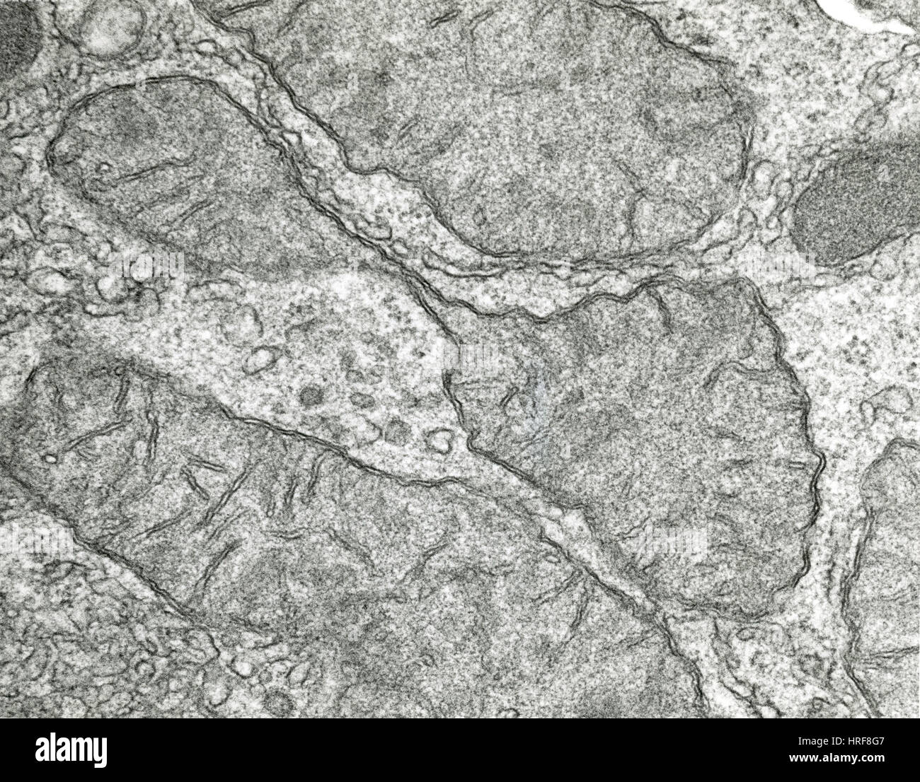 Dividing Mitochondrion, Liver Cell TEM Stock Photo - Alamy