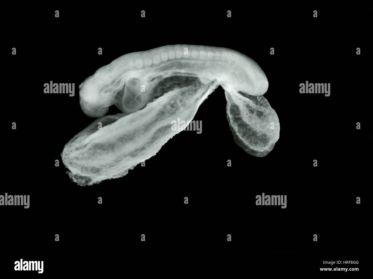 23 day old human embryo Stock Photo - Alamy