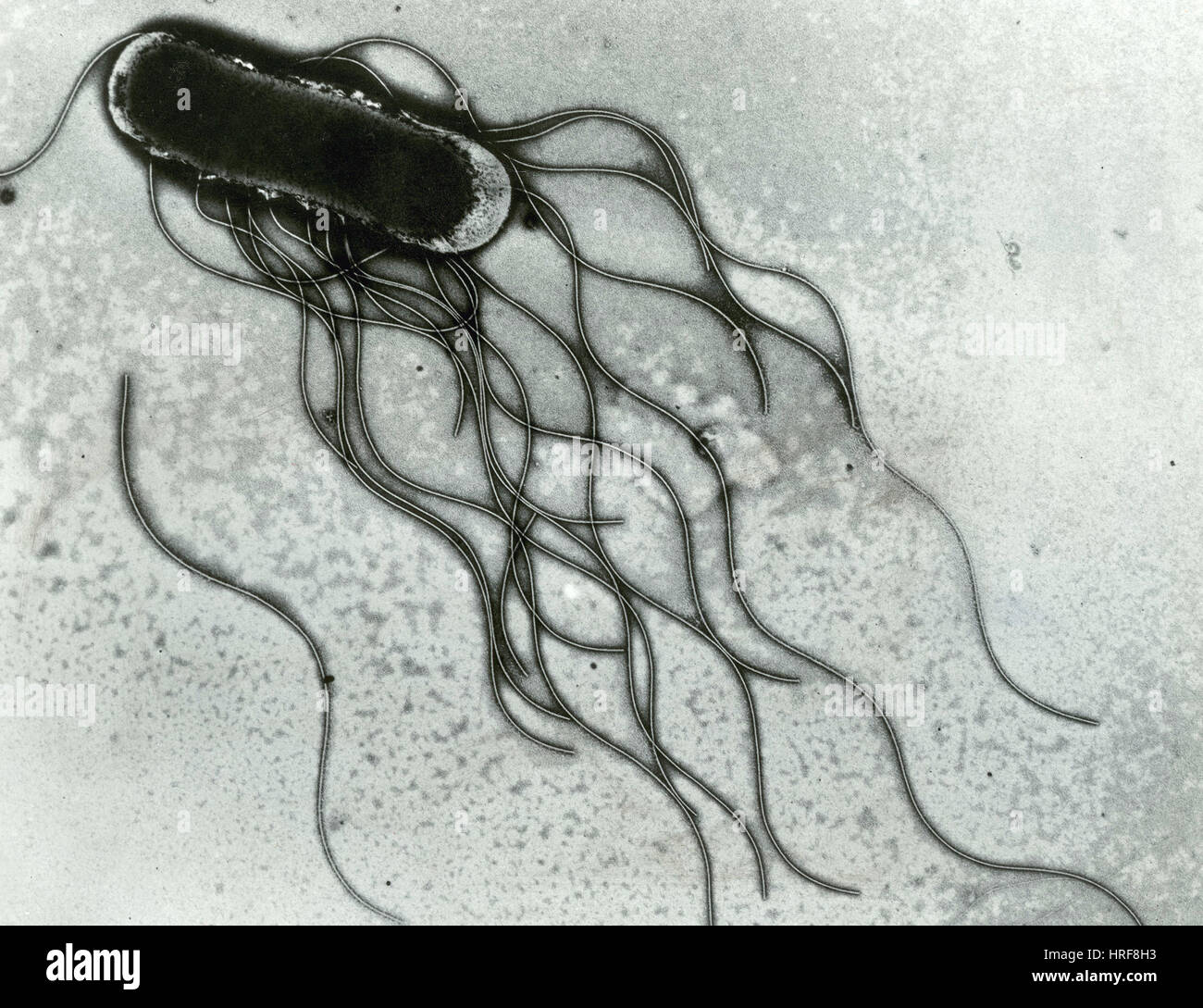 Salmonella paratyphoid hi-res stock photography and images - Alamy