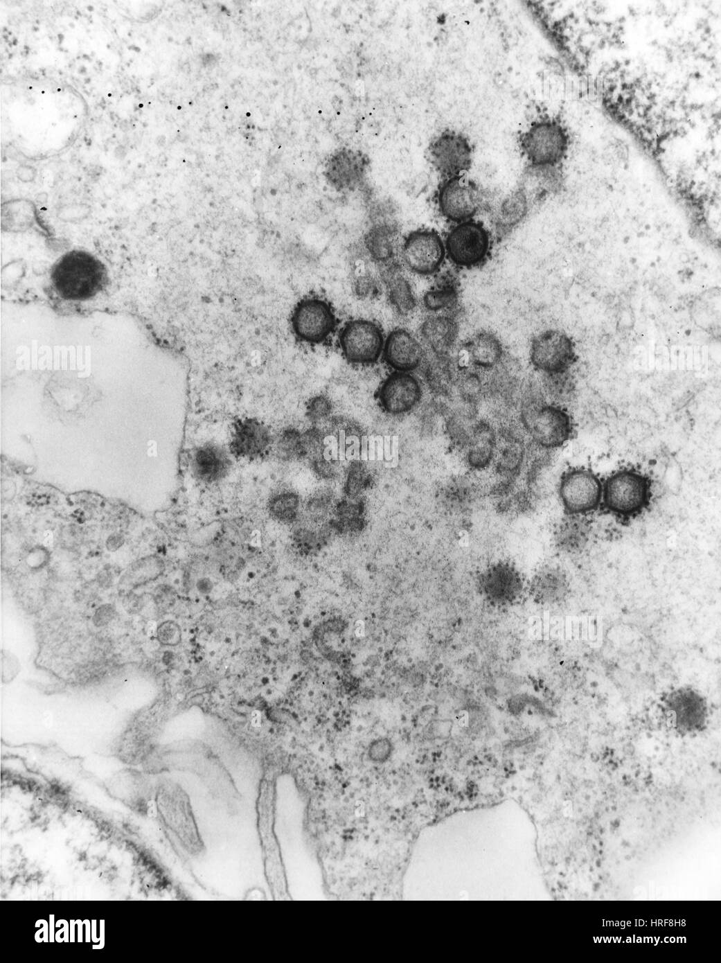 Medicine fever Black and White Stock Photos & Images - Alamy