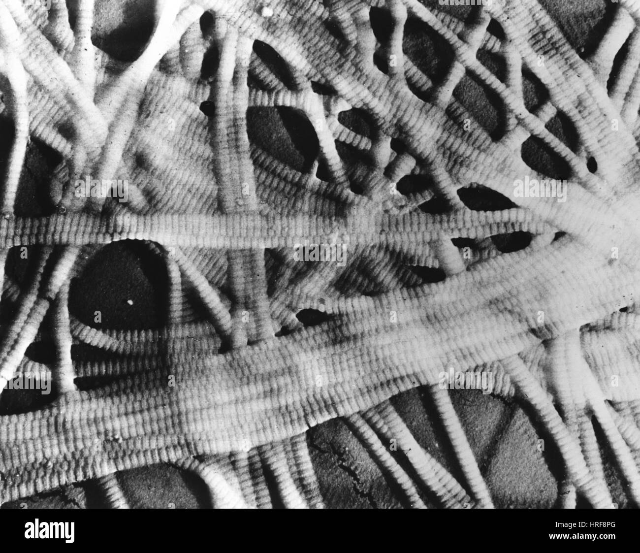 Subcutaneous tissue hi-res stock photography and images - Alamy