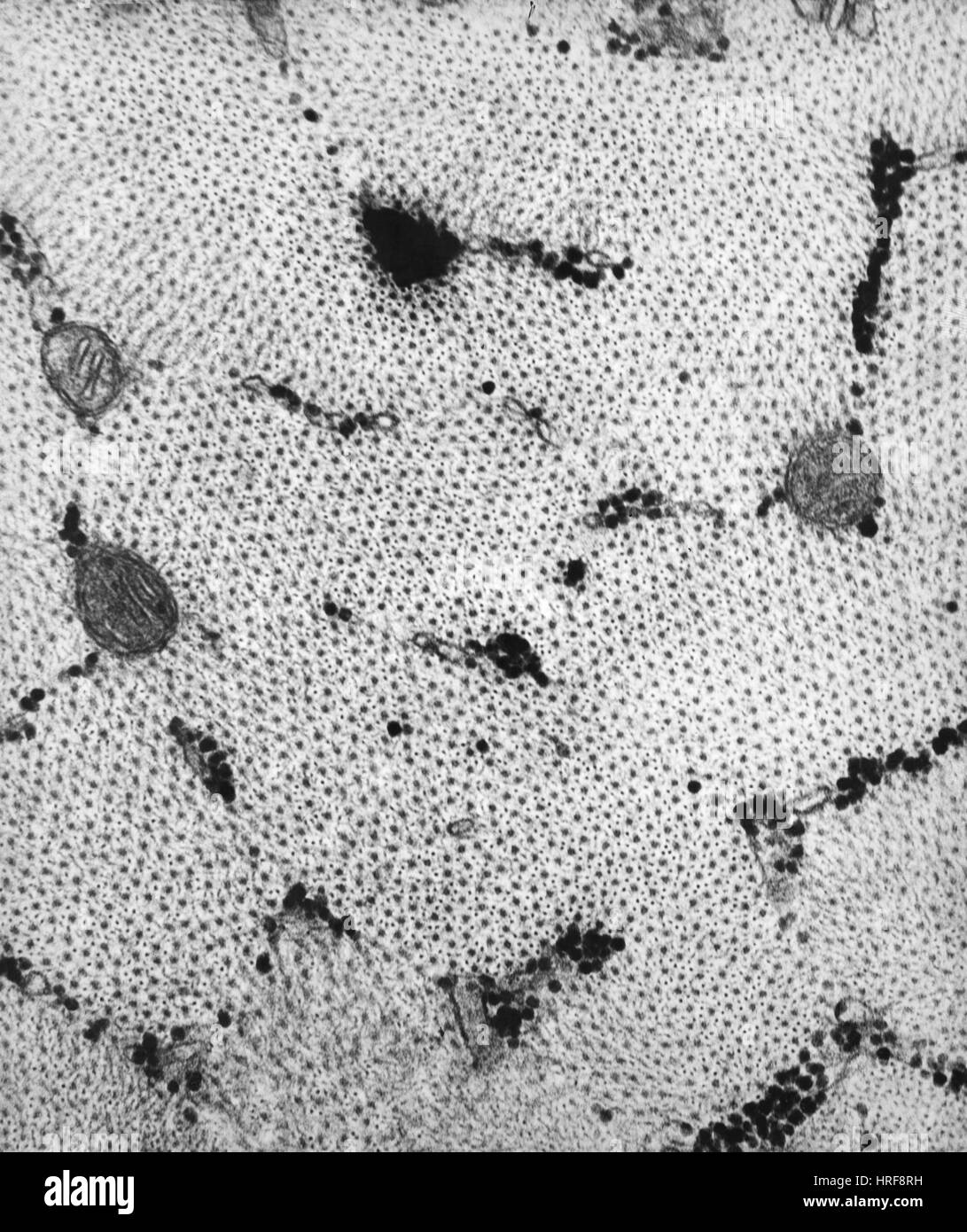 Skeletal Muscle Tissue Stock Photos & Skeletal Muscle Tissue Stock ...