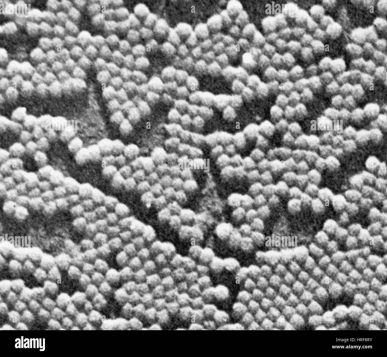 Poliovirus Electron Micrograph