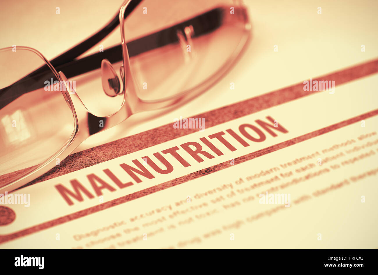 Malnutrition - Printed Diagnosis on Red Background and Spectacles Lying ...
