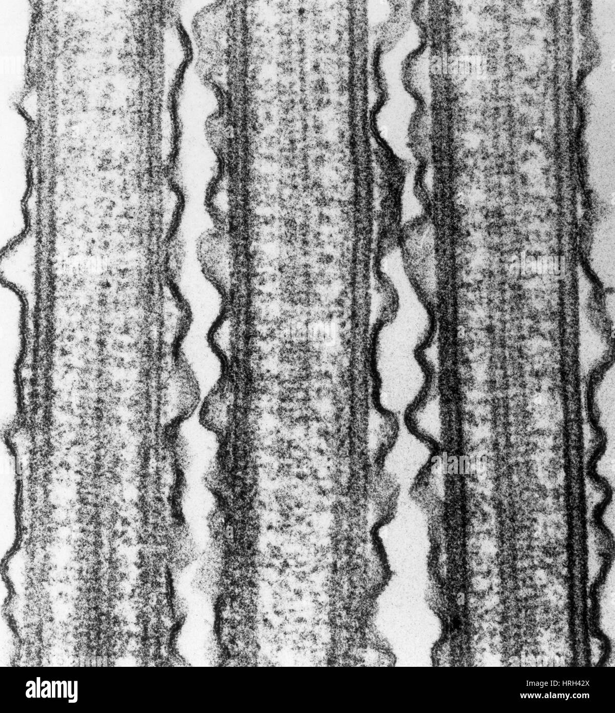 Cilia electron micrograph hi-res stock photography and images - Alamy