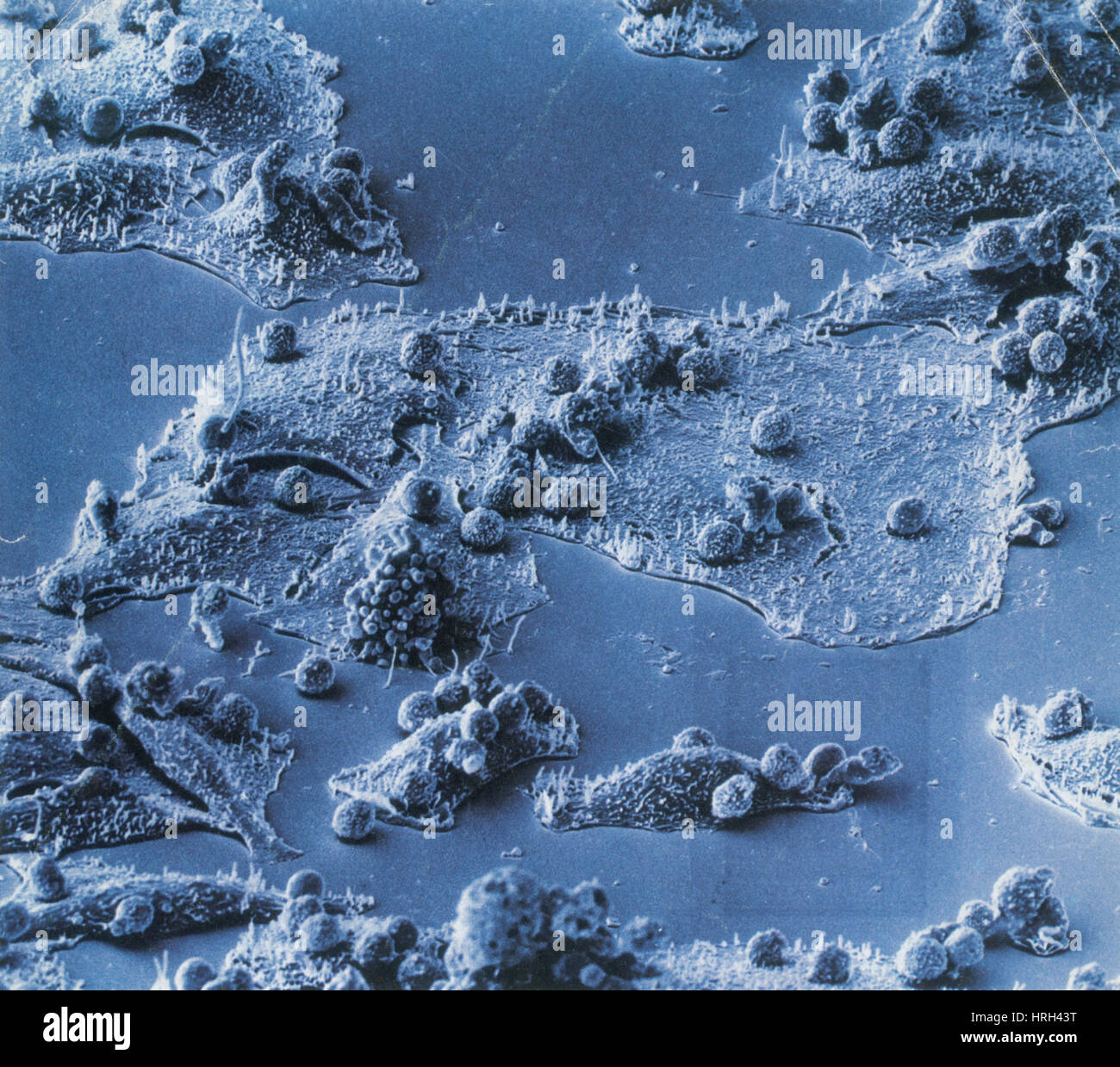 Cancer cell white blood cell sem hi-res stock photography and images ...