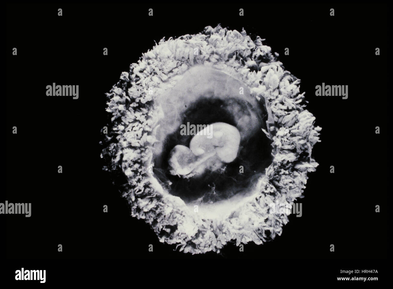 Scanning electron micrograph embryo hi-res stock photography and images ...
