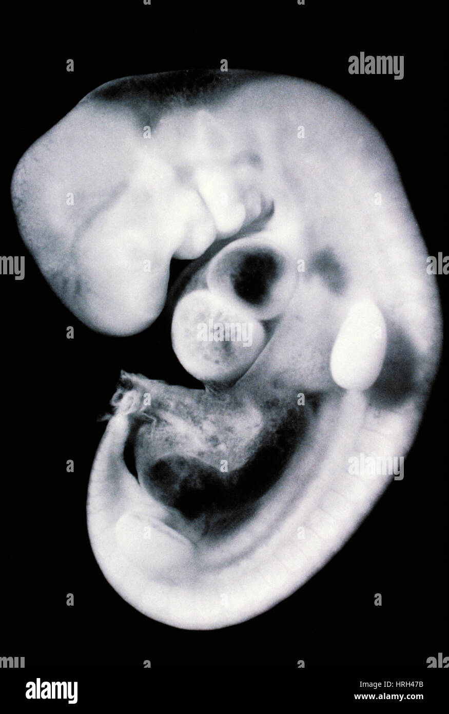 Human Embryo Micrograph High Resolution Stock Photography and Images ...